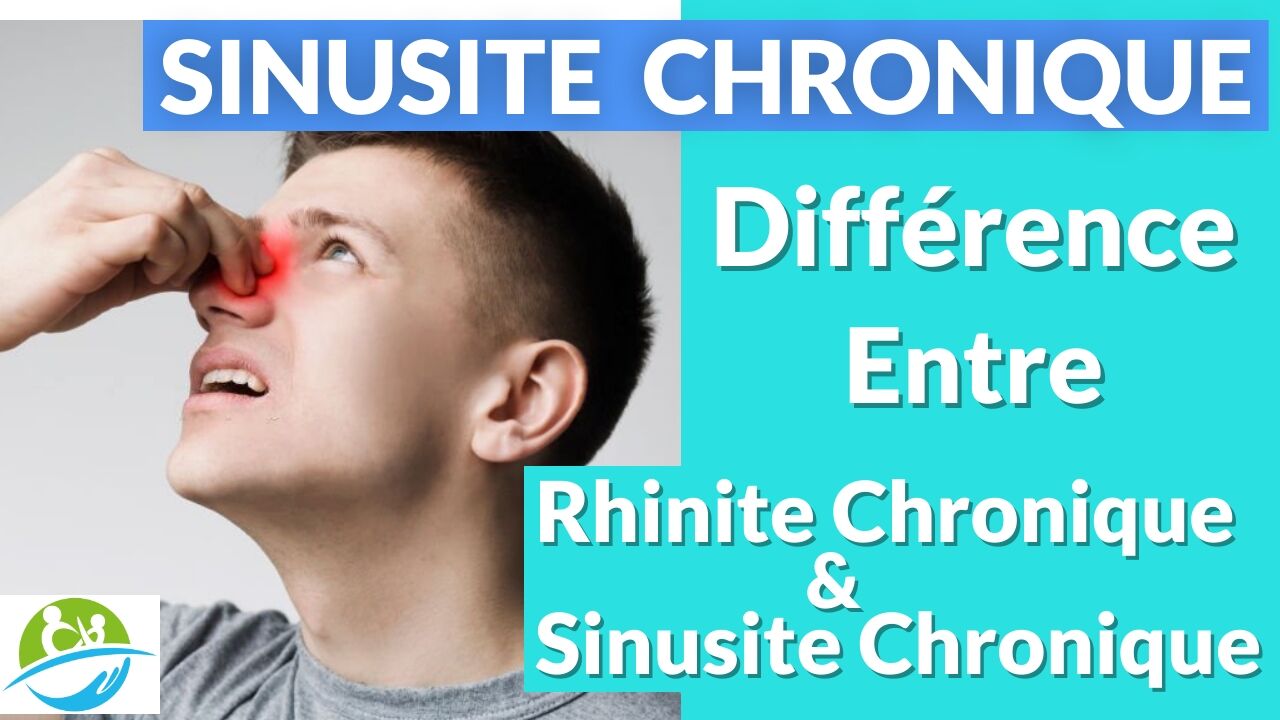 SINUSITE CHRONIQUE: Différence entre Rhinite Chronique et Sinusite ...